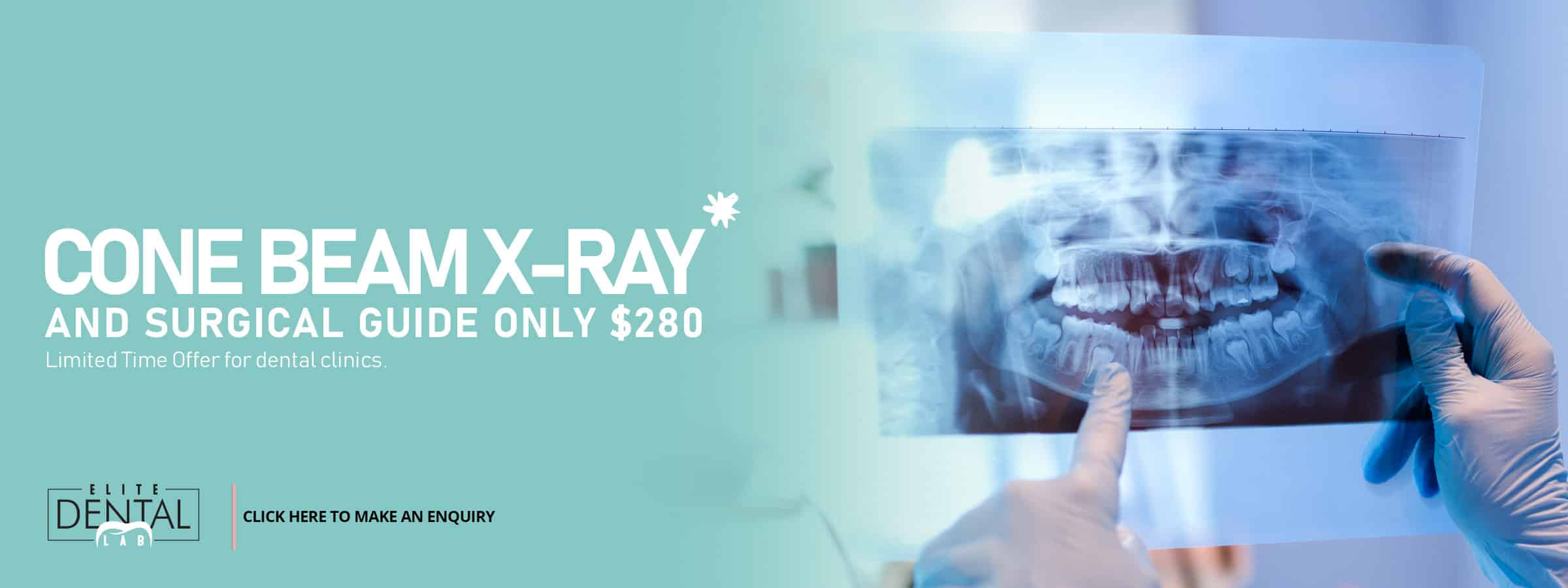 Cone Beam Dental Imaging - Dental XRay - Dental Cone Beam CT Scan